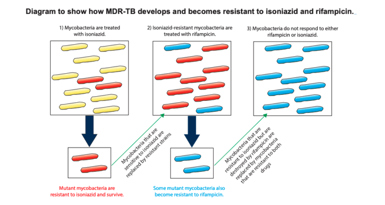 Multidrug-resistant tuberculosis (MDR-TB) - European Lung Foundation