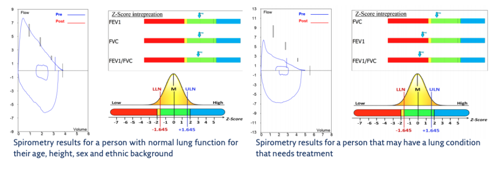 Testing your lungs: spirometry - European Lung Foundation
