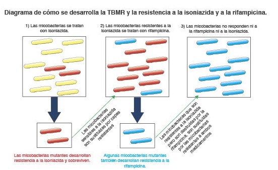 Tuberculosis multirresistente (TBMR) - European Lung Foundation