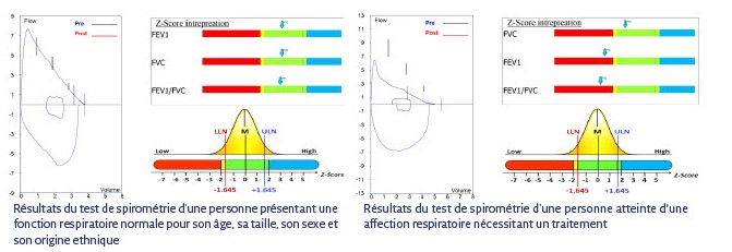 Testez votre souffle : la spirométrie - European Lung Foundation