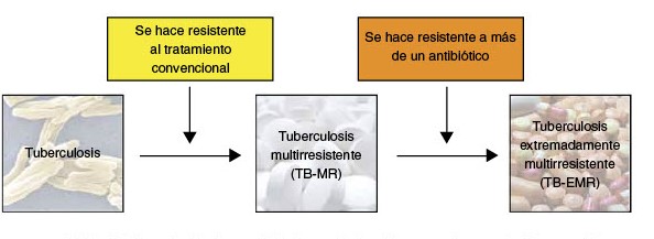 Tuberculosis - European Lung Foundation